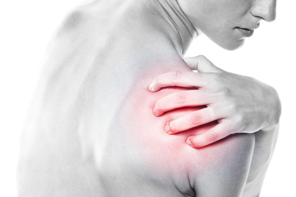 Spalla congelata o spalla misteriosa - 4 Woman Health
